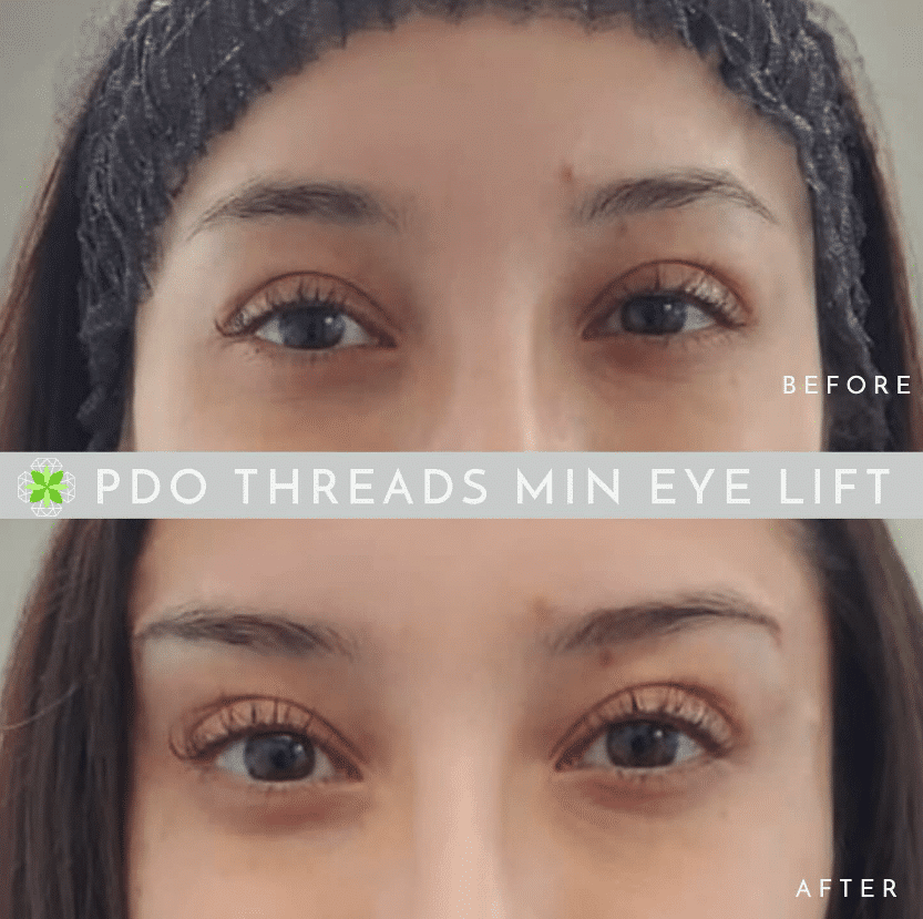 Eyebrow Threading Boca Raton